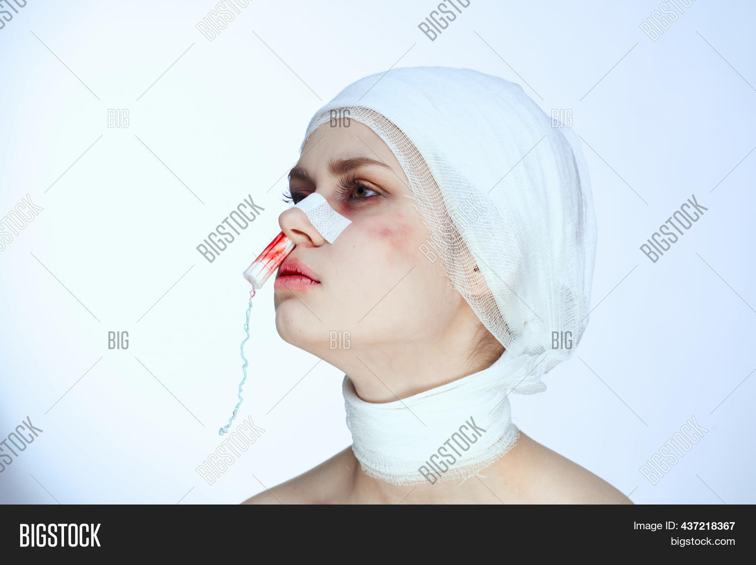 Woman Bruised Face Image & Photo (Free Trial) | Bigstock