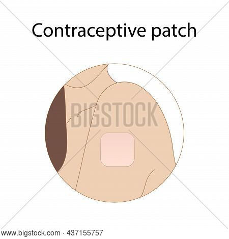 Contraceptive Patch. Vector & Photo (Free Trial) | Bigstock