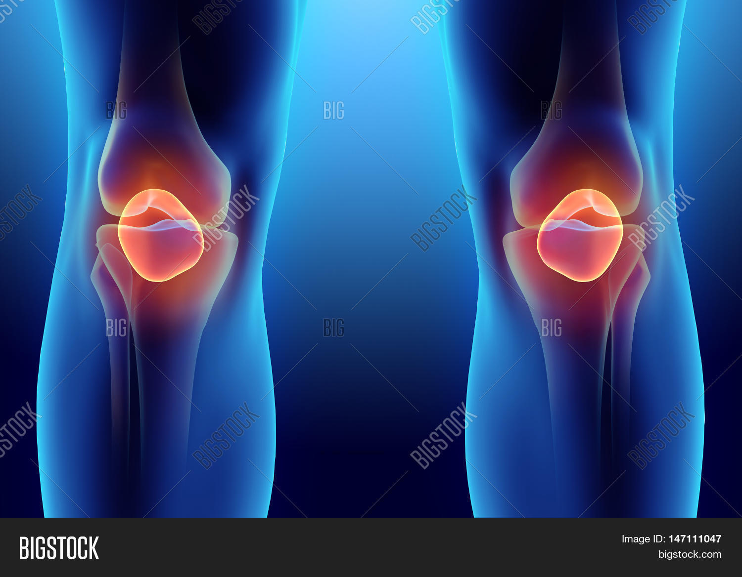 3D Illustration Image & Photo (Free Trial) | Bigstock