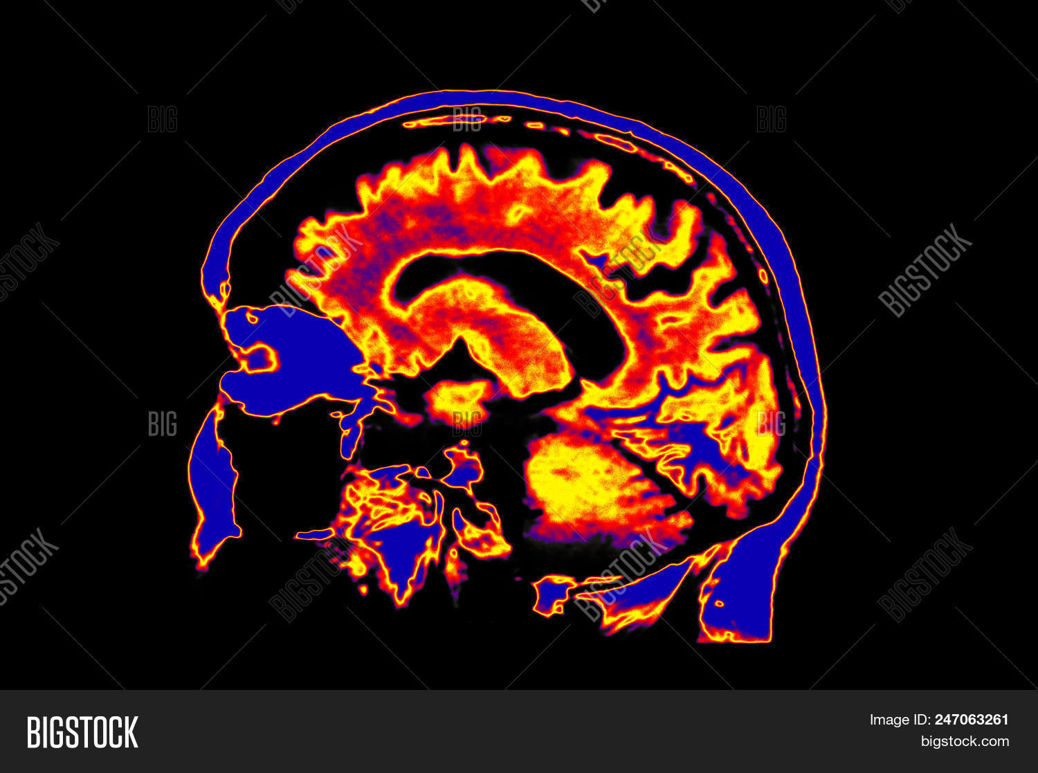 Colorized Mri Image Image & Photo (Free Trial) | Bigstock