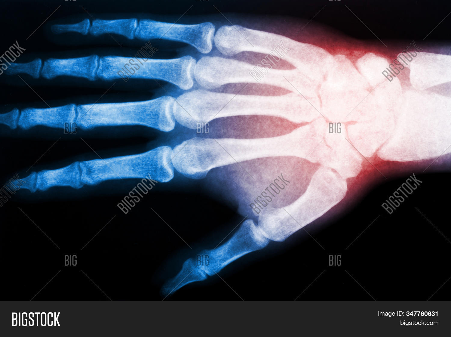 X Ray Scan Hand. Red Image & Photo (Free Trial) | Bigstock