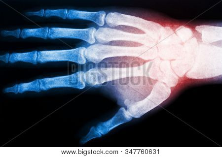 X Ray Scan Hand. Red Image & Photo (Free Trial) | Bigstock