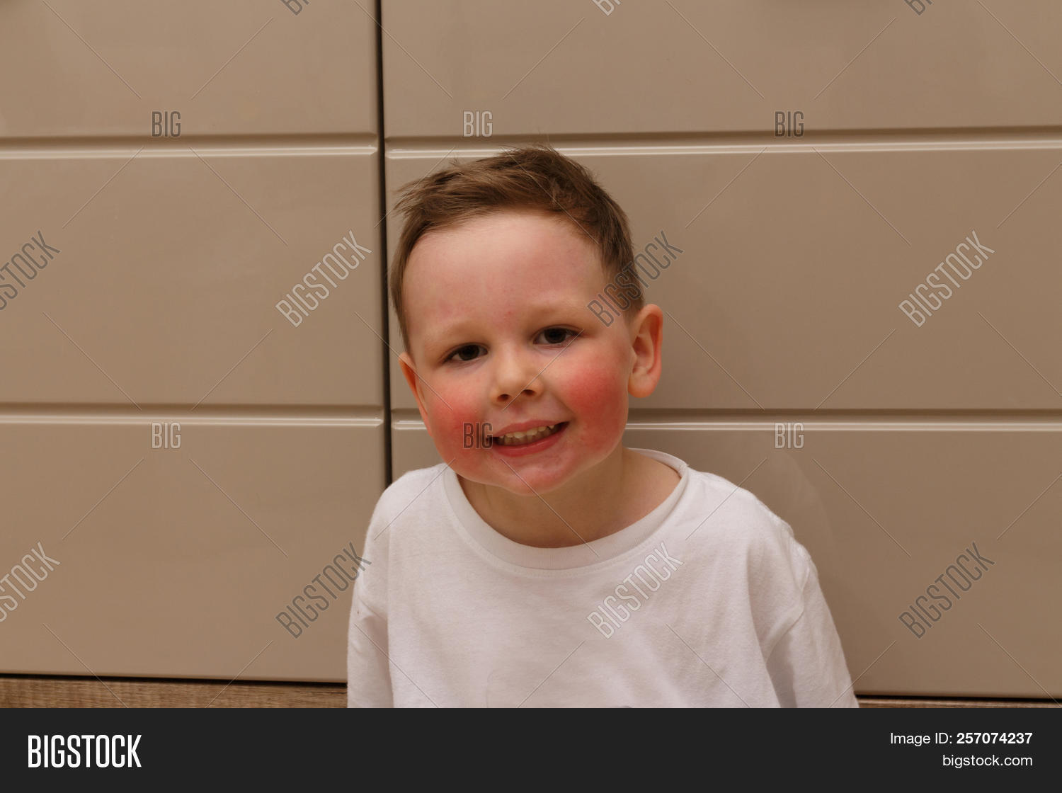 Boy Has Red Cheeks, Image & Photo (Free Trial) | Bigstock