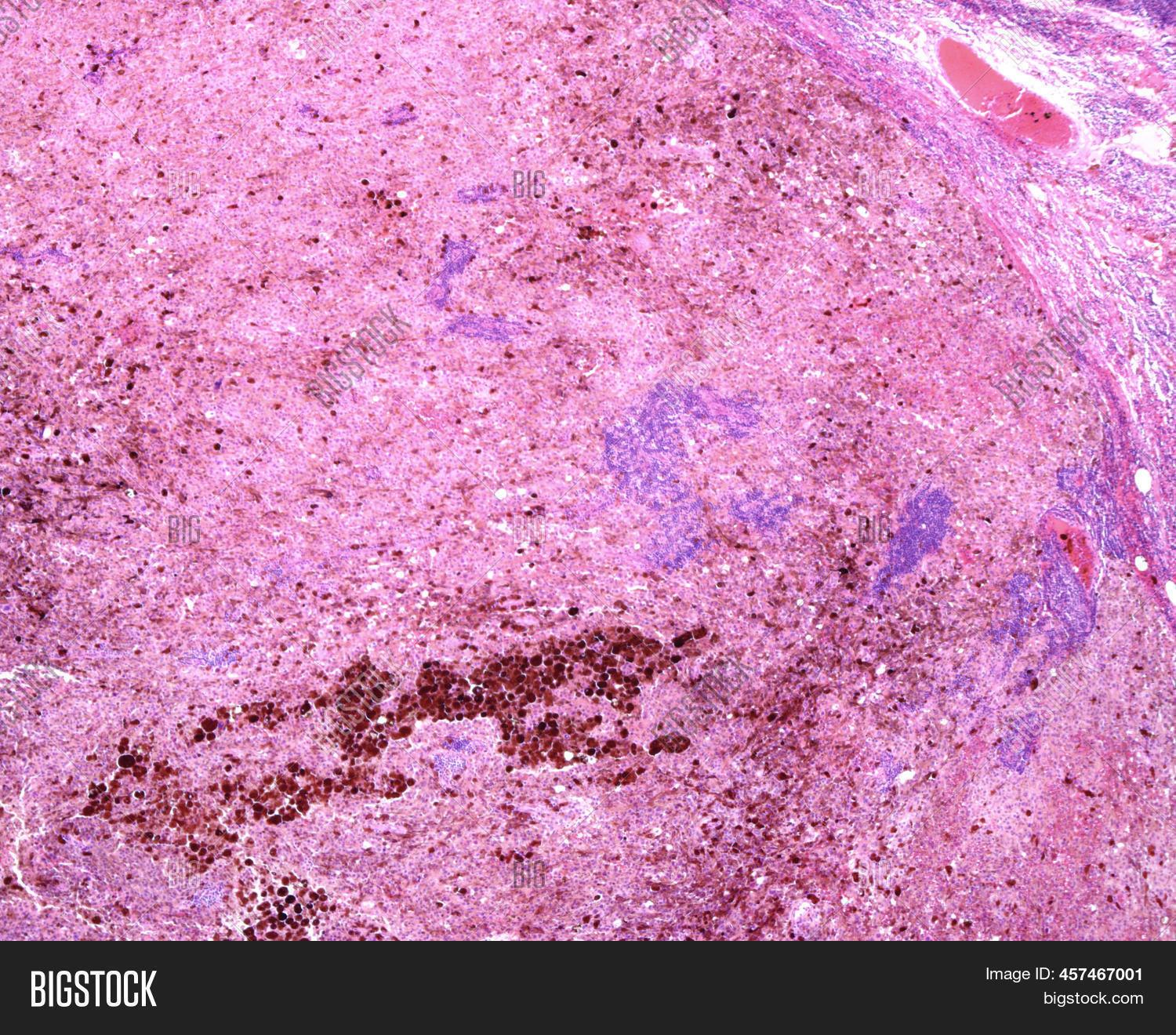 Low Magnification Image & Photo (Free Trial) | Bigstock