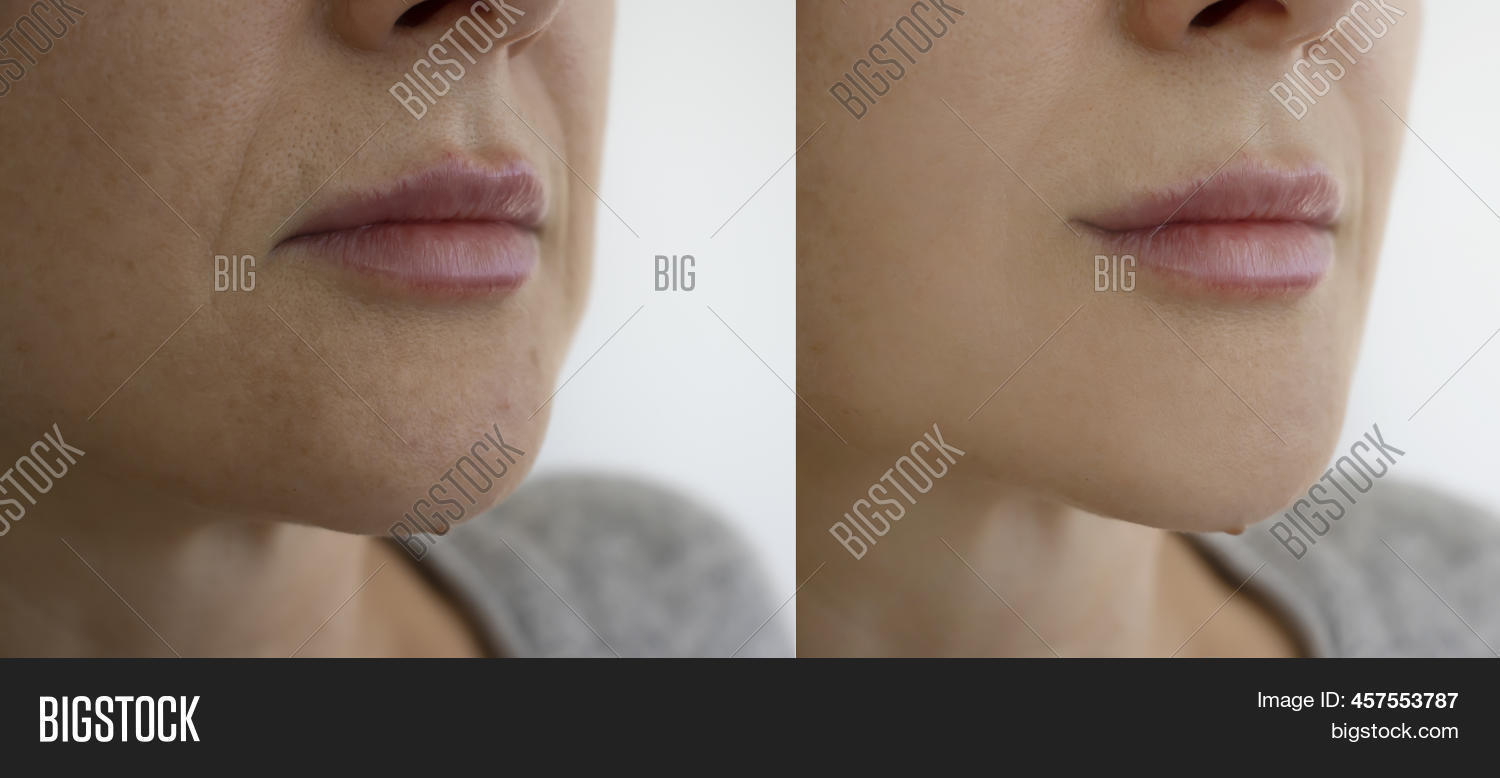 Woman Face Wrinkles Image & Photo (Free Trial) | Bigstock