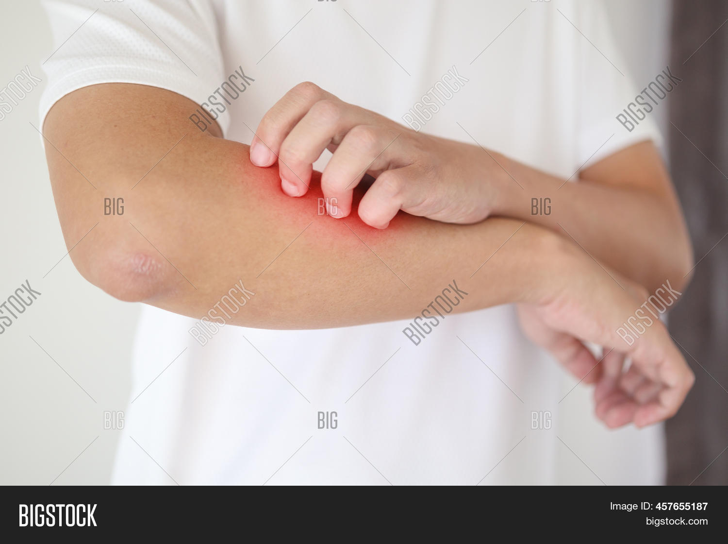 Man Itching Scratching Image & Photo (Free Trial) | Bigstock