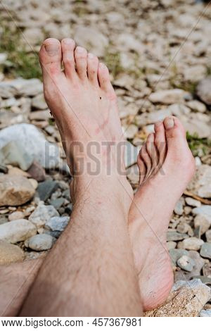 Scratch On Skin 图片和照片（免费试用） | Bigstock
