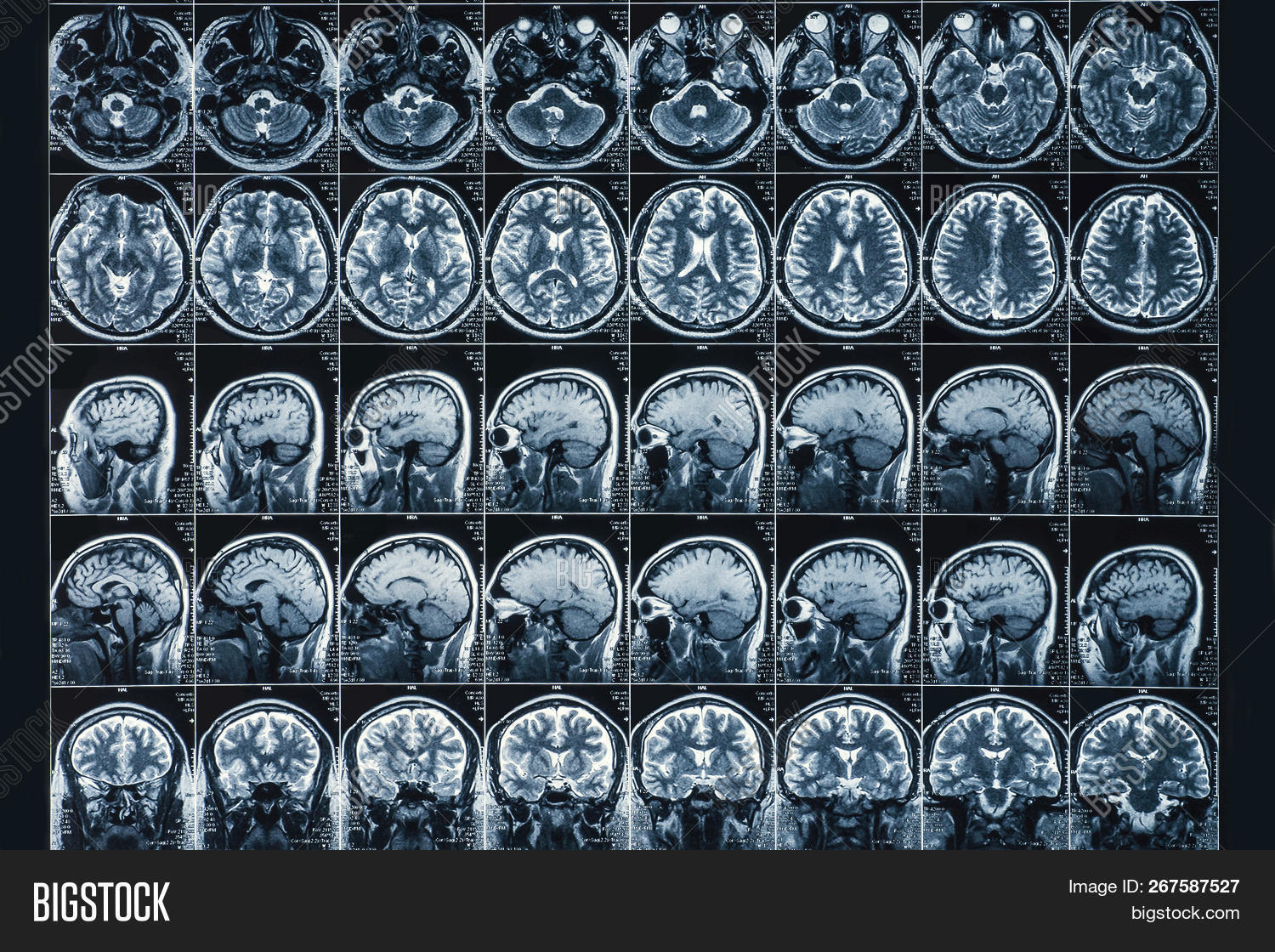 X-ray Mri Scan Image & Photo (Free Trial) | Bigstock