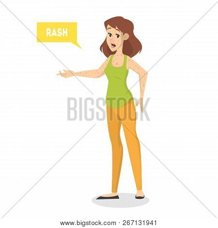 Woman Skin Full Rash Vector & Photo (Free Trial) | Bigstock