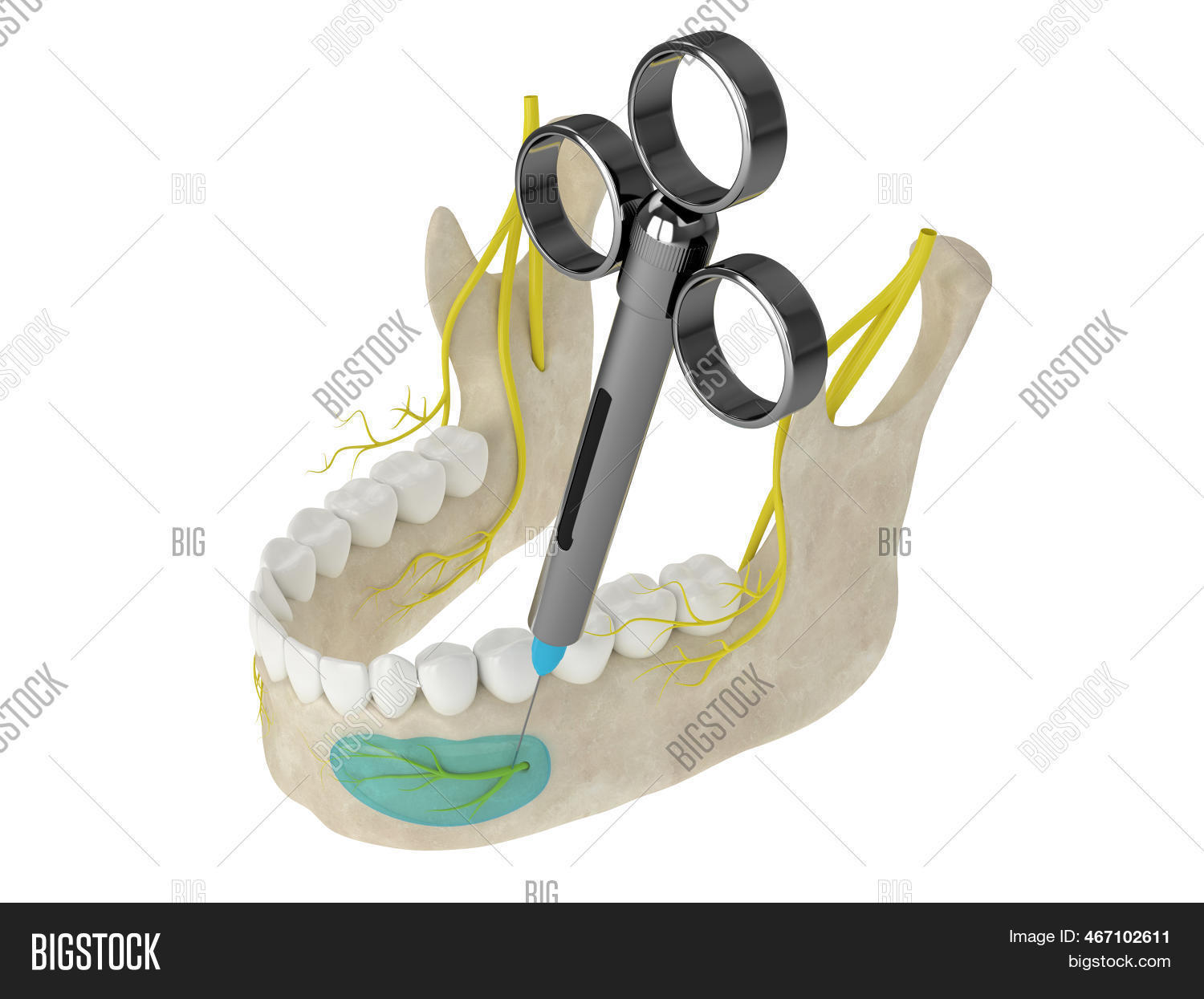 Mandibular Arch Image & Photo (Free Trial) | Bigstock