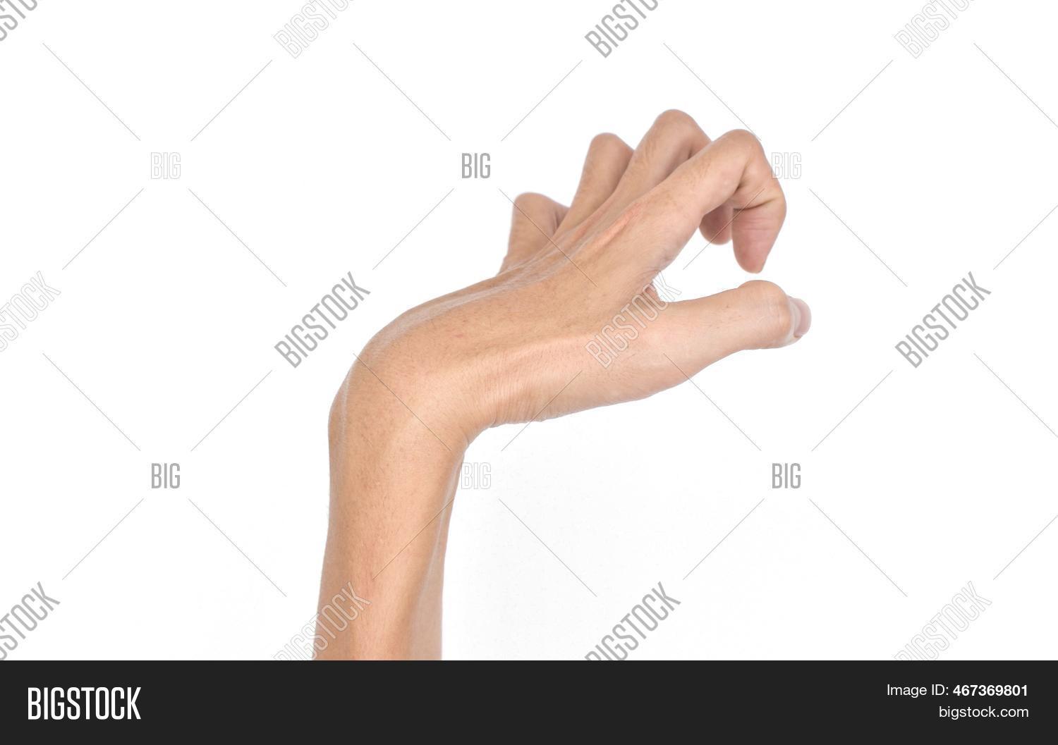 Volkmann's Contracture Image & Photo (Free Trial) | Bigstock