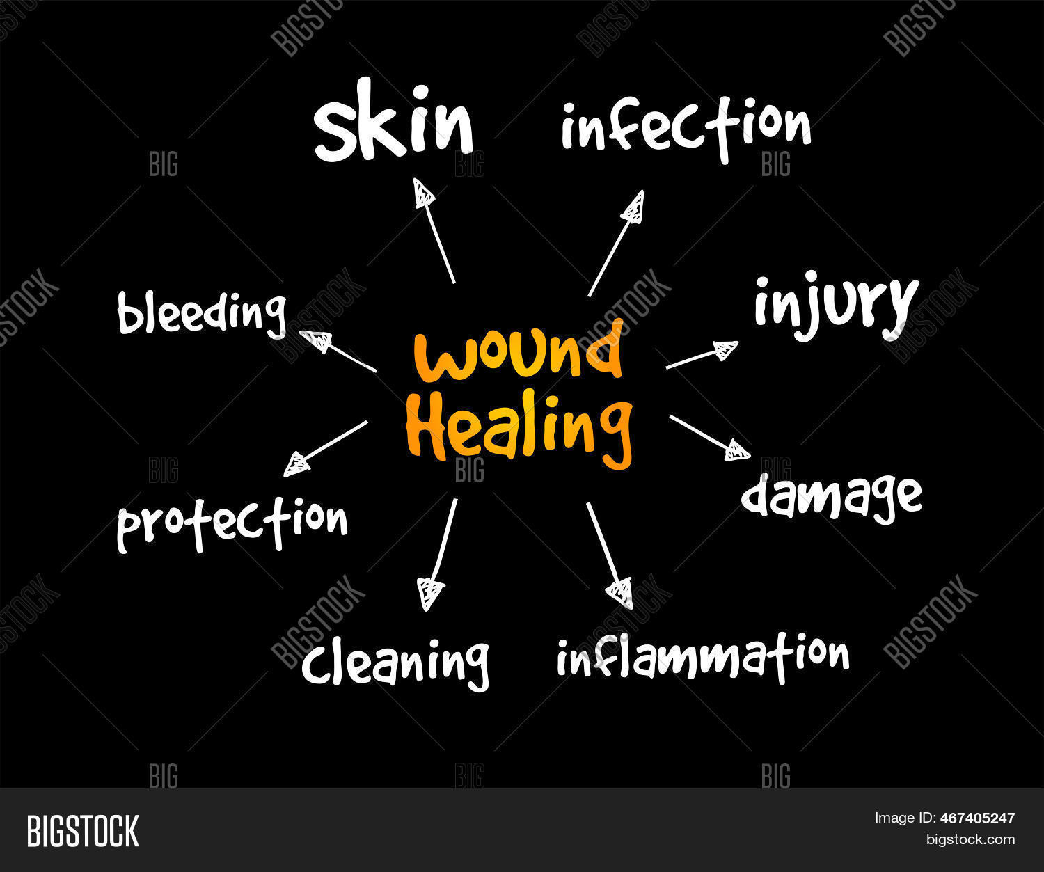 Wound Healing Mind Map Image & Photo (Free Trial) | Bigstock