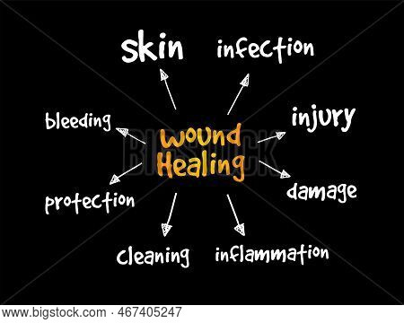 Wound Healing Mind Map Image & Photo (Free Trial) | Bigstock