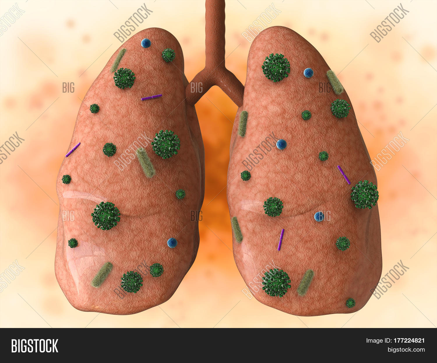 Lung Disease Bacteria Image & Photo (Free Trial) | Bigstock