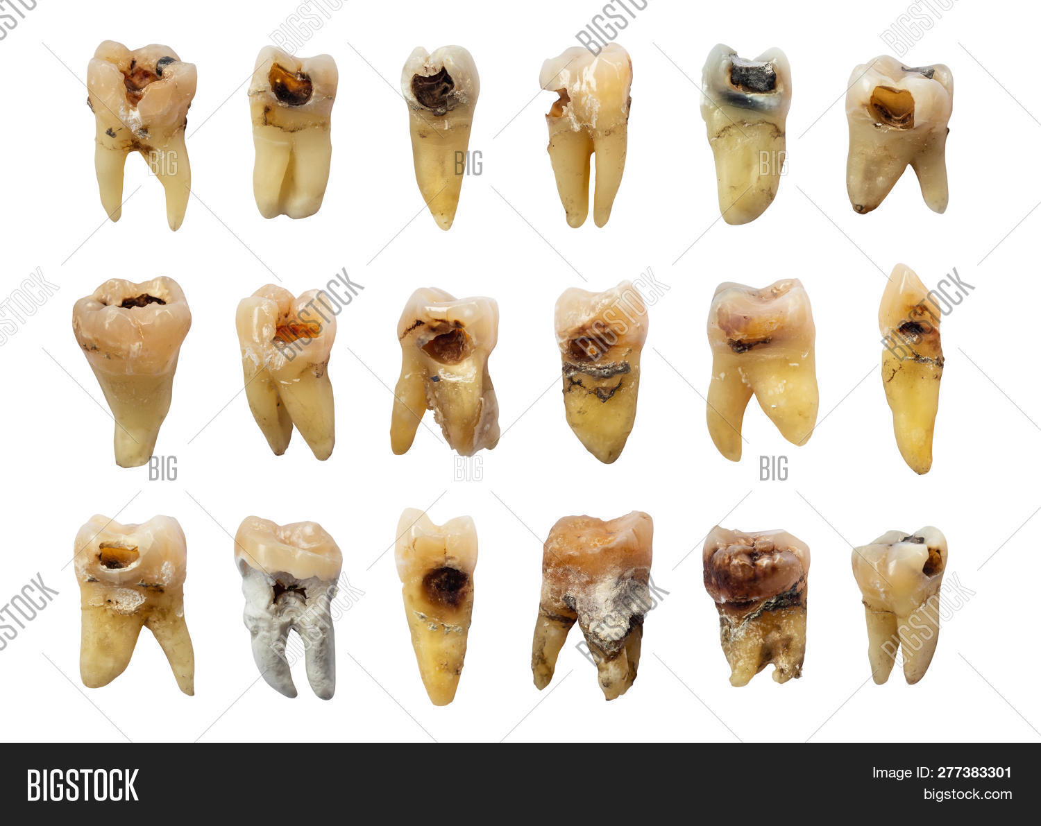 Set Teeth Dental Image & Photo (Free Trial) | Bigstock