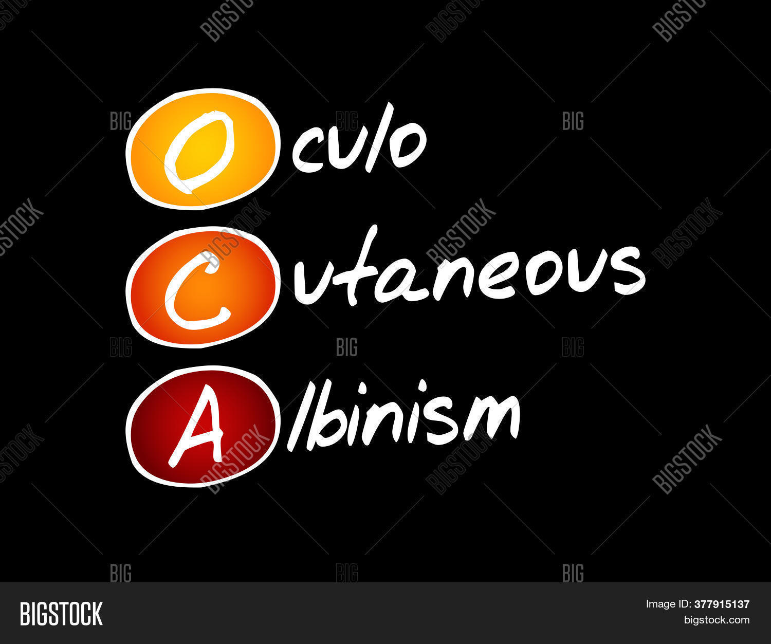 Oca - Oculo Cutaneous Image & Photo (Free Trial) | Bigstock