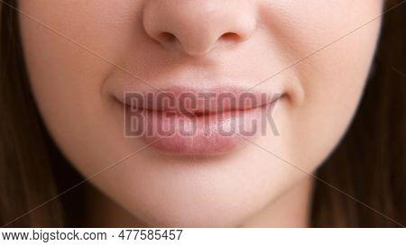 Lip Plumping. Female Image & Photo (Free Trial) | Bigstock