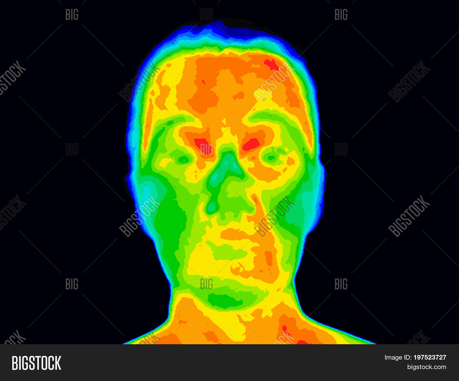 Thermographic Photo Image & Photo (Free Trial) | Bigstock