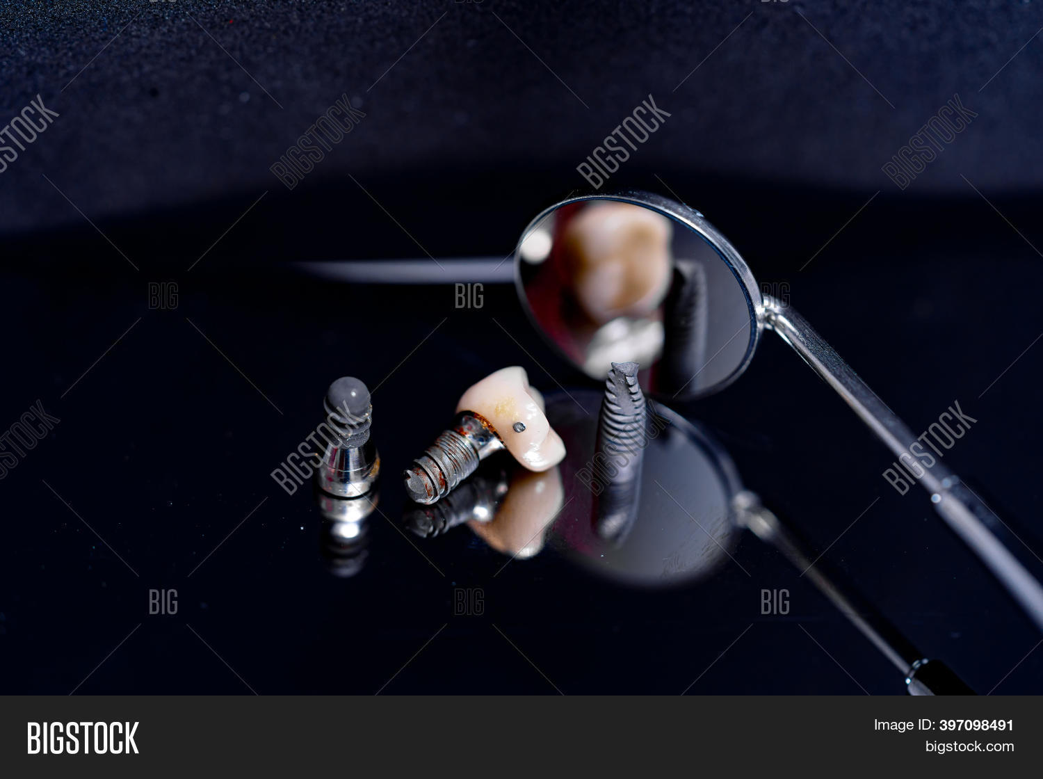 Metal Cast Post Core Image & Photo (Free Trial) | Bigstock