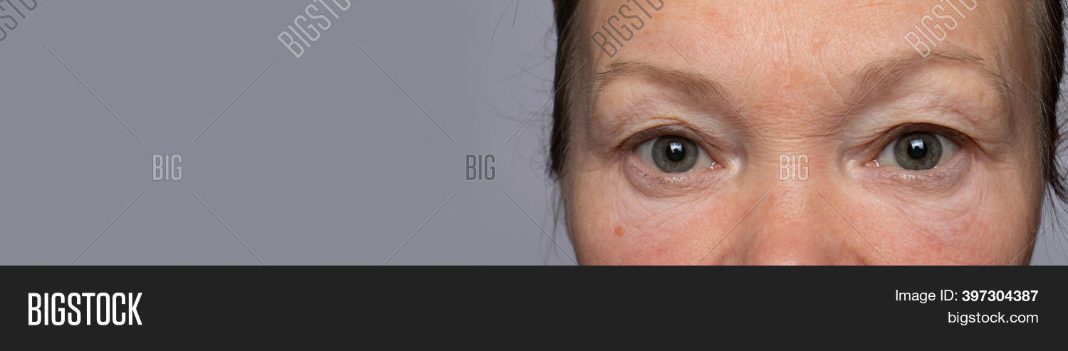 Eyes Old Man, Aging Image & Photo (Free Trial) | Bigstock