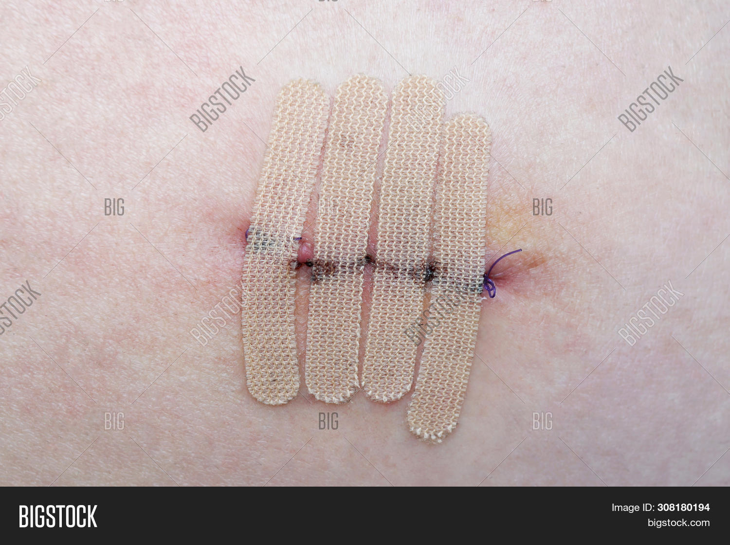 Close- Human Skin Image & Photo (Free Trial) | Bigstock