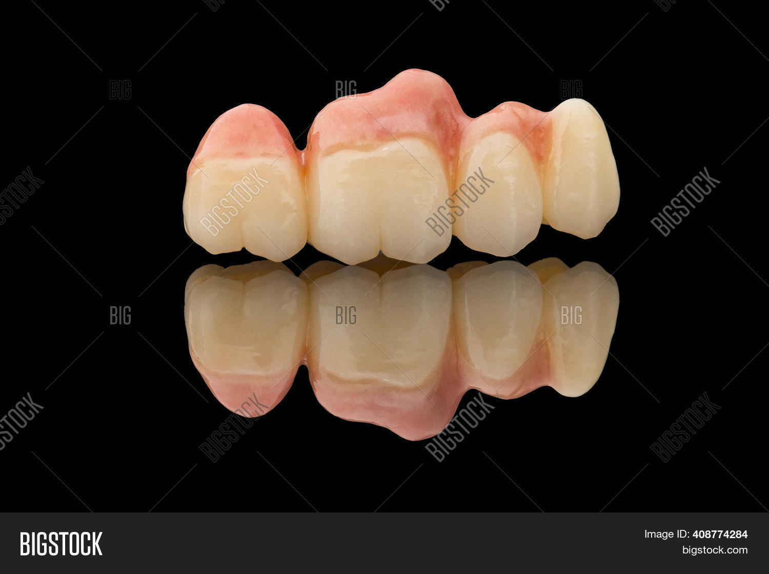Dental Bridge 4 Teeth Image & Photo (Free Trial) | Bigstock