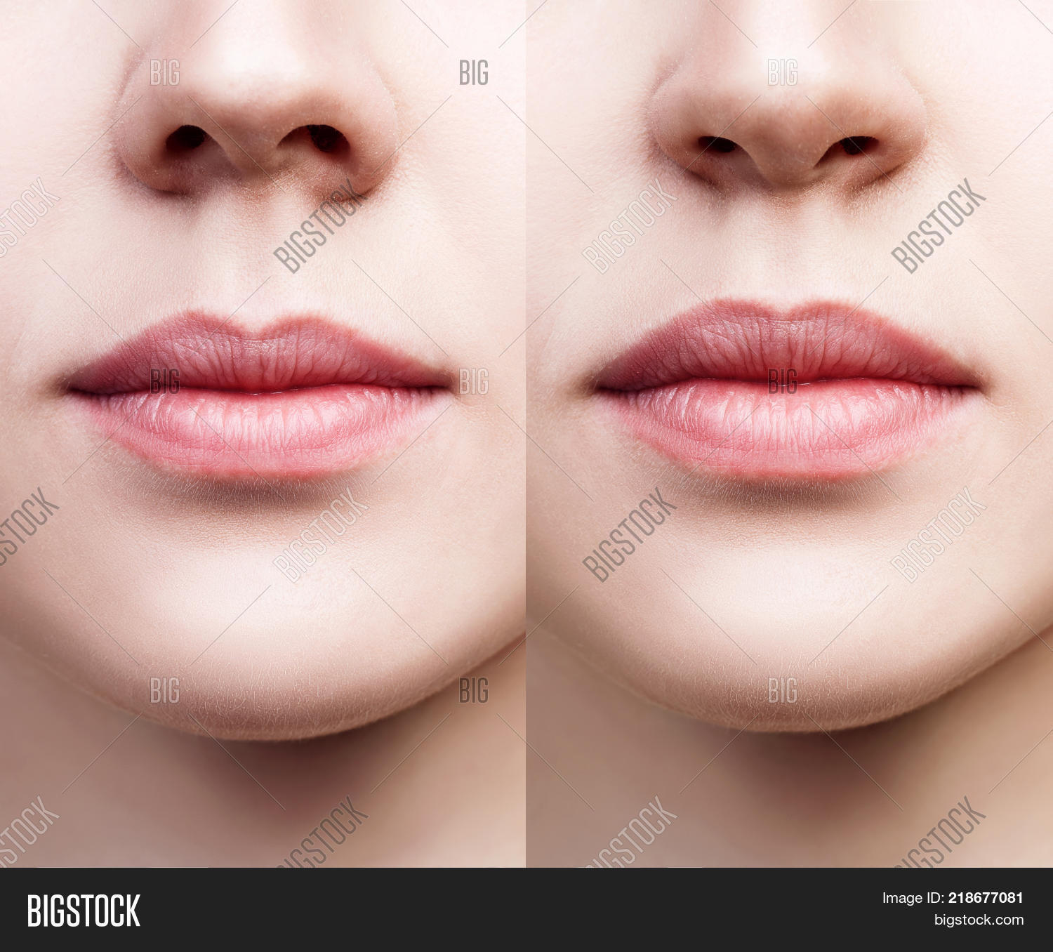 Front View On Female Image & Photo (Free Trial) | Bigstock