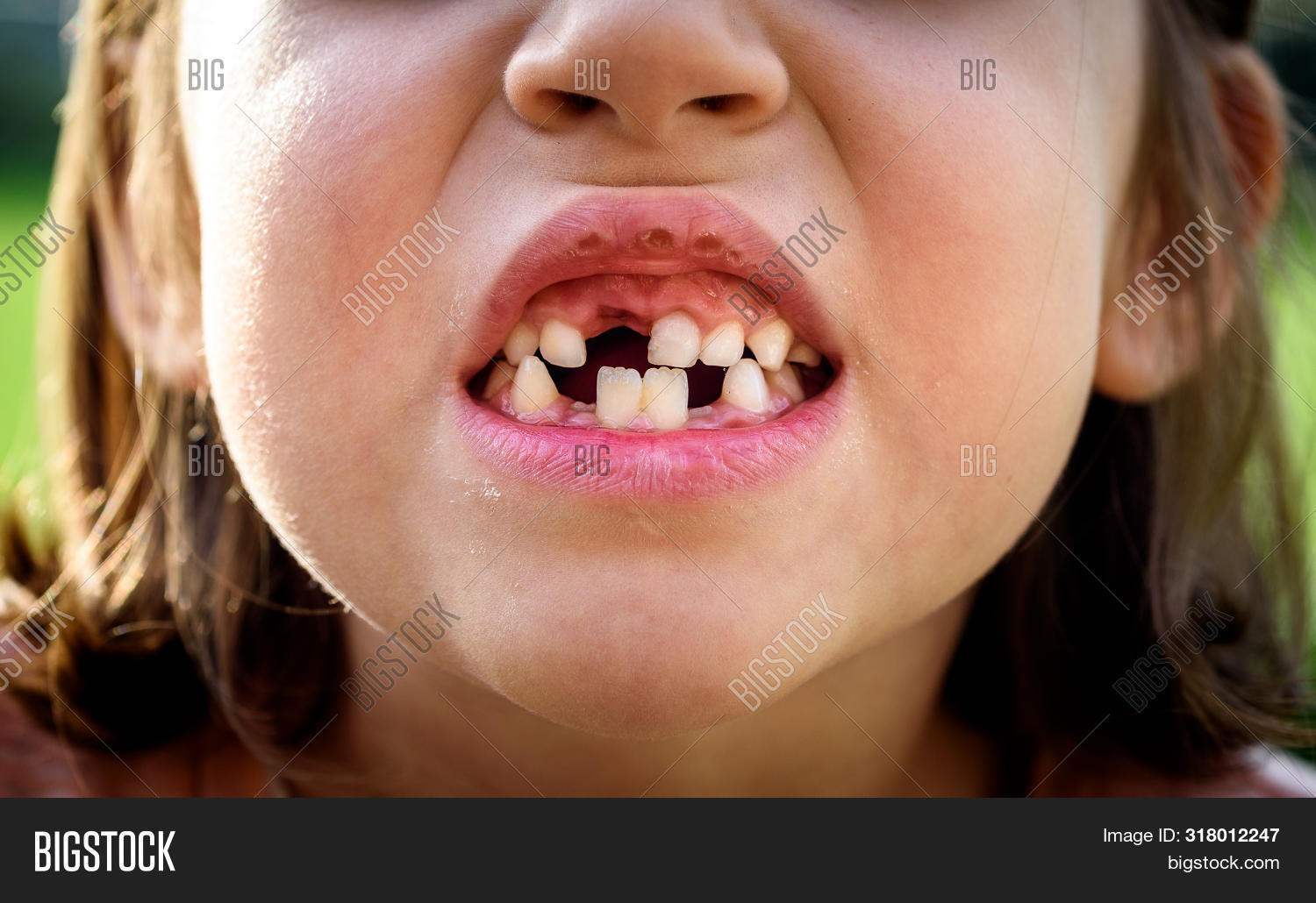 Portrait Toothless Image & Photo (Free Trial) | Bigstock