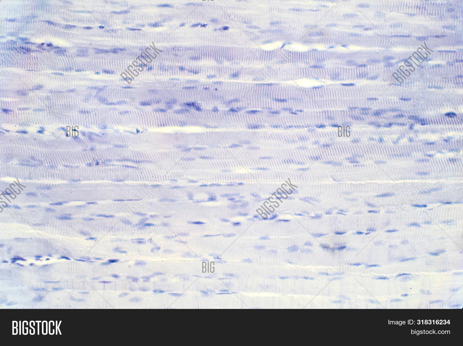 Human Skeletal Muscle Image & Photo (Free Trial) | Bigstock