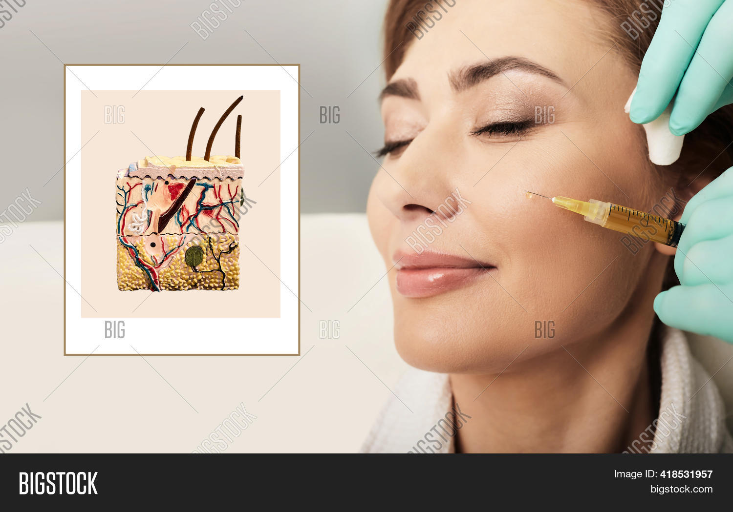 Facial Prp Therapy. Image & Photo (Free Trial) | Bigstock