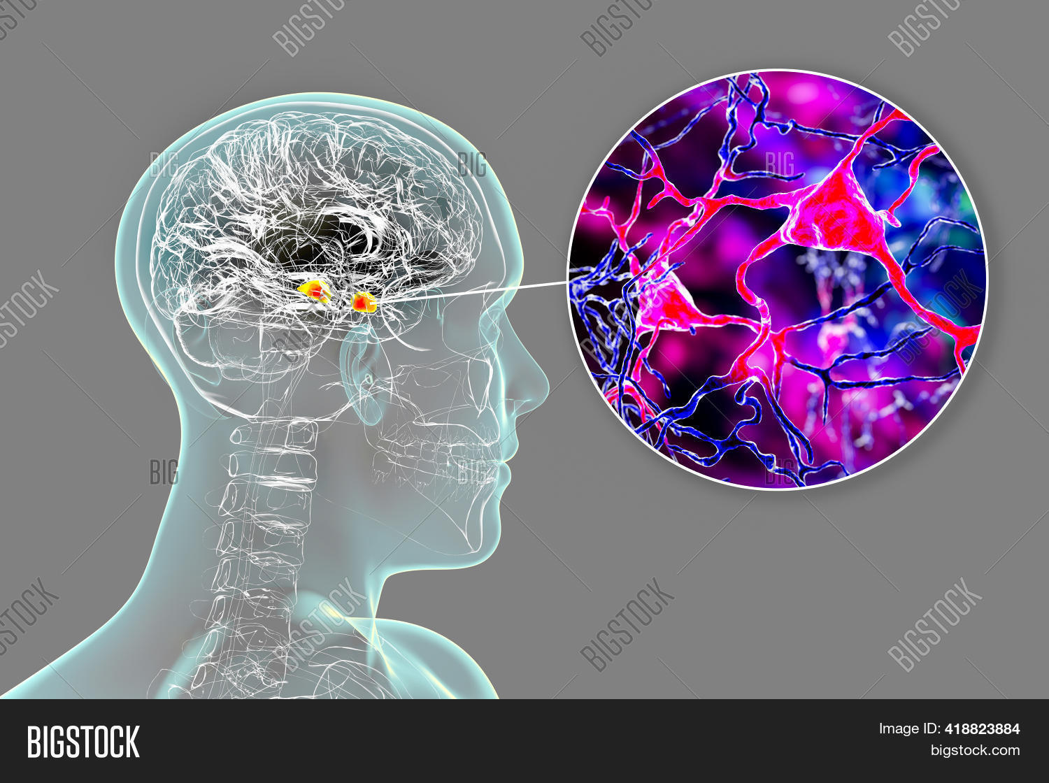 Amygdala Brain, Image & Photo (Free Trial) | Bigstock