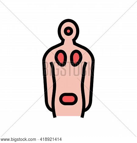 Decubitus Ulcers Vector & Photo (Free Trial) | Bigstock