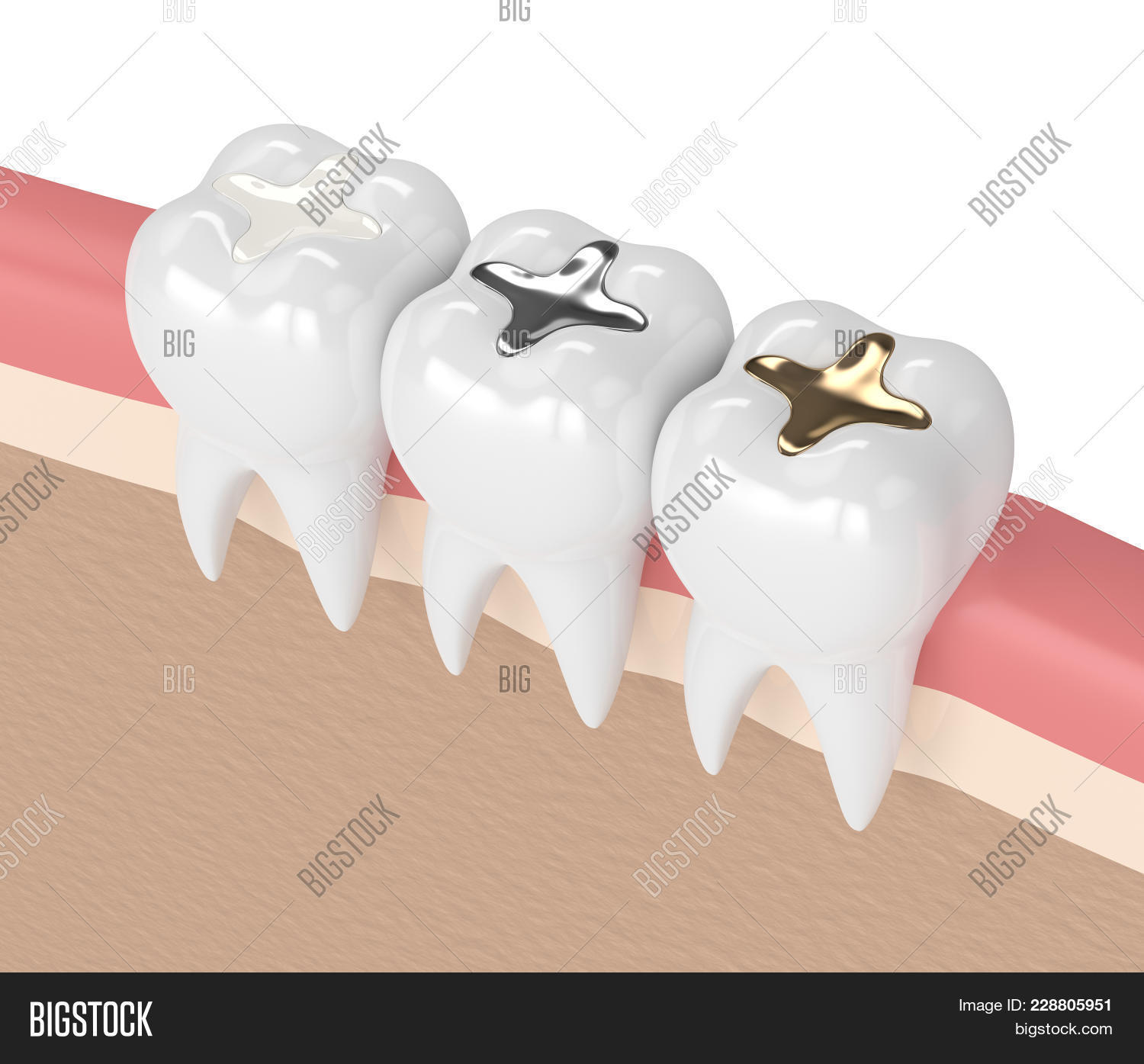 3D Render Teeth Image & Photo (Free Trial) | Bigstock