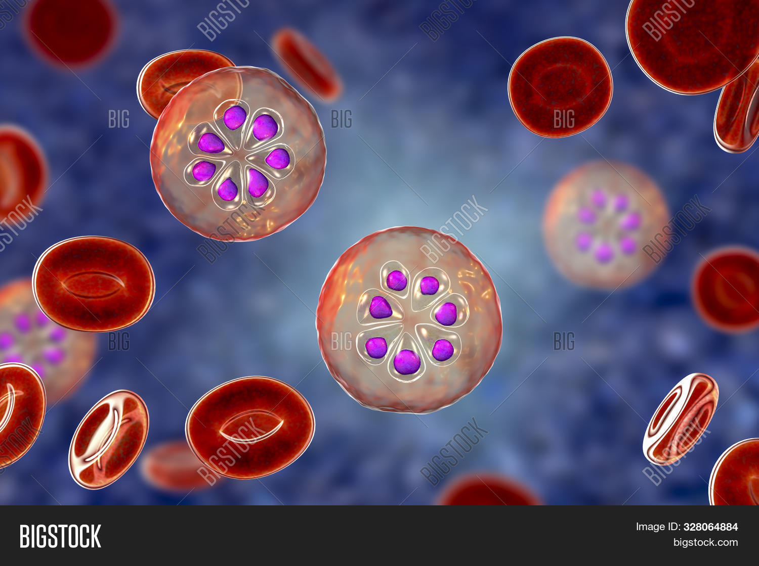 Malaria-infected Red Image & Photo (Free Trial) | Bigstock