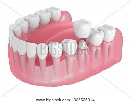 3D Render Jaw Teeth Image & Photo (Free Trial) | Bigstock