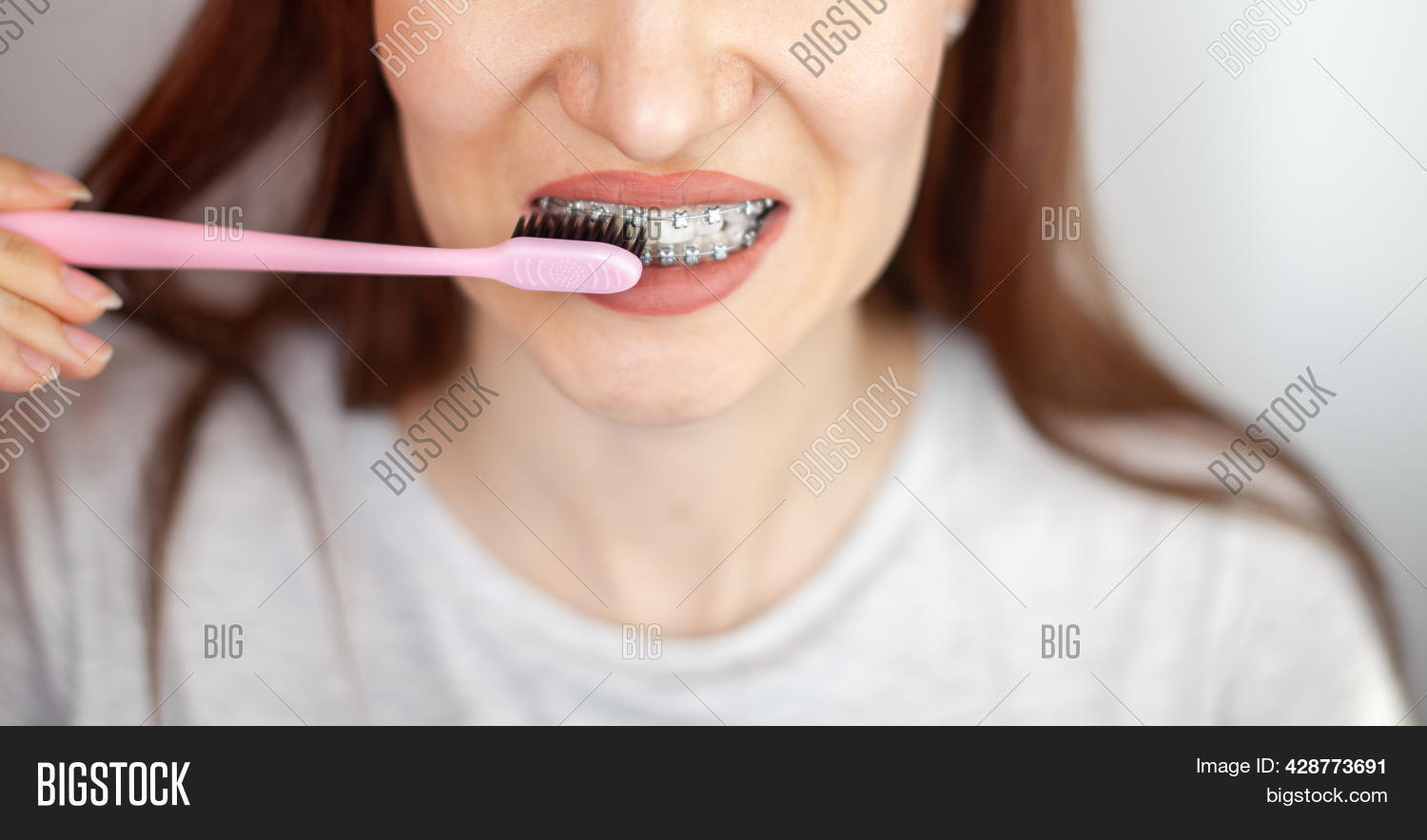 Girl Braces On Her Image And Photo Free Trial Bigstock