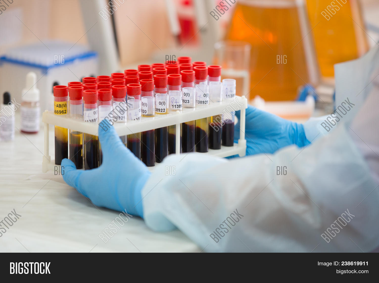 Blood Test.blood Test Image & Photo (Free Trial) | Bigstock