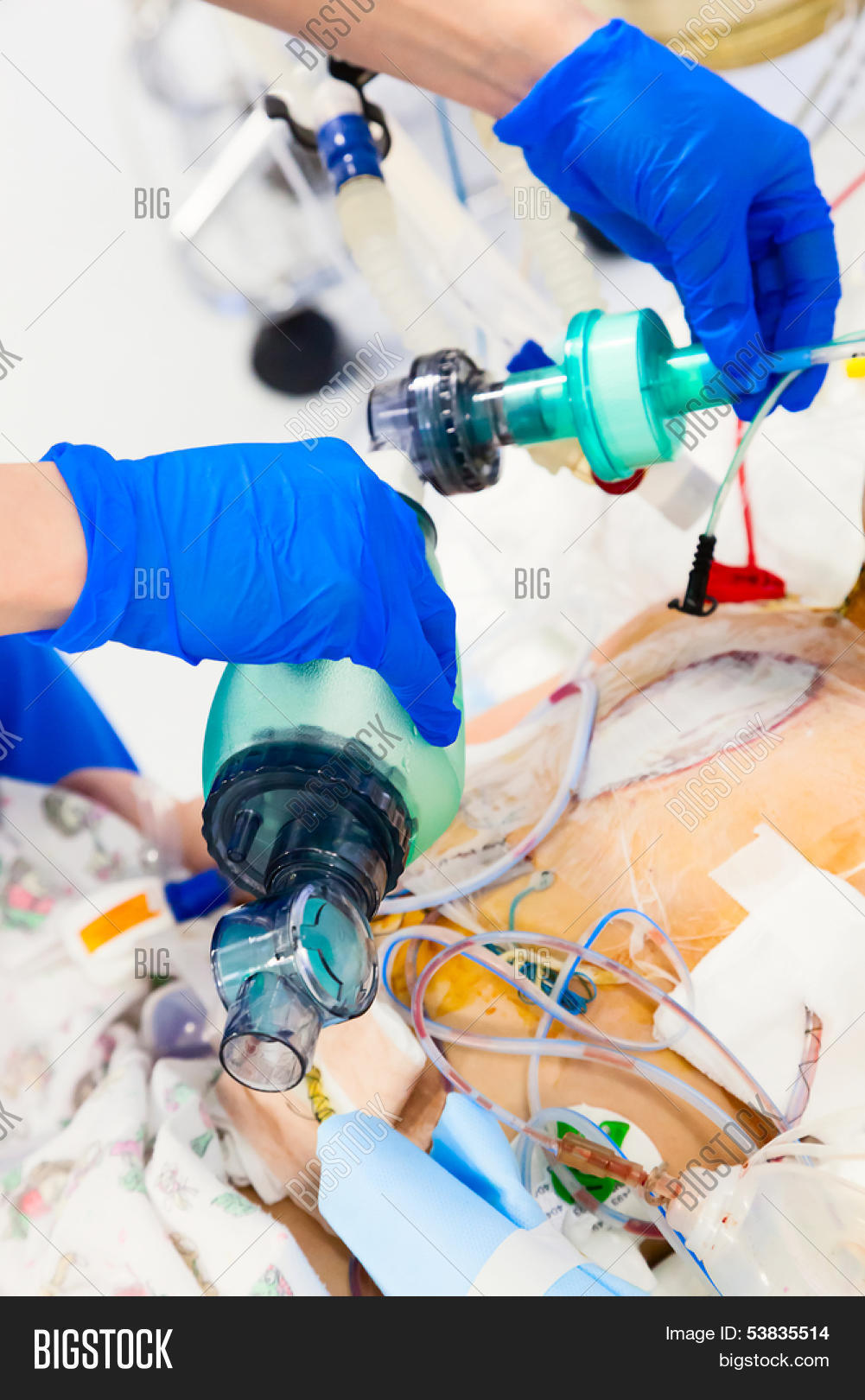 Artificial Ventilation Image & Photo (Free Trial) | Bigstock