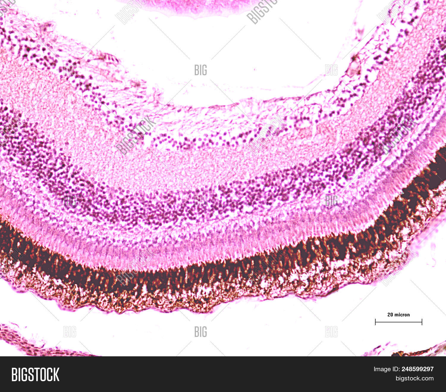 Section Fish Retina Image & Photo (Free Trial) | Bigstock
