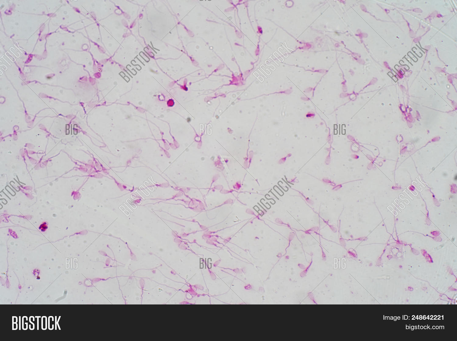 Human Sperm Morphology Image & Photo (Free Trial) | Bigstock