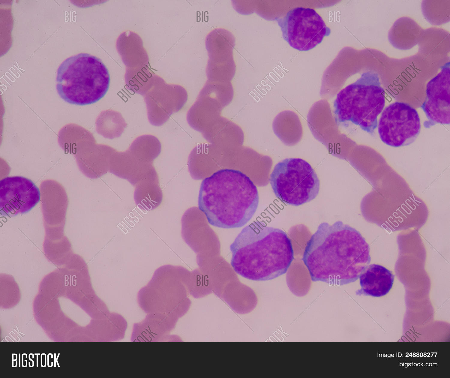 Blood Smear Show Image & Photo (Free Trial) | Bigstock