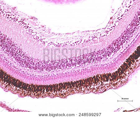 Section Fish Retina Image & Photo (Free Trial) | Bigstock