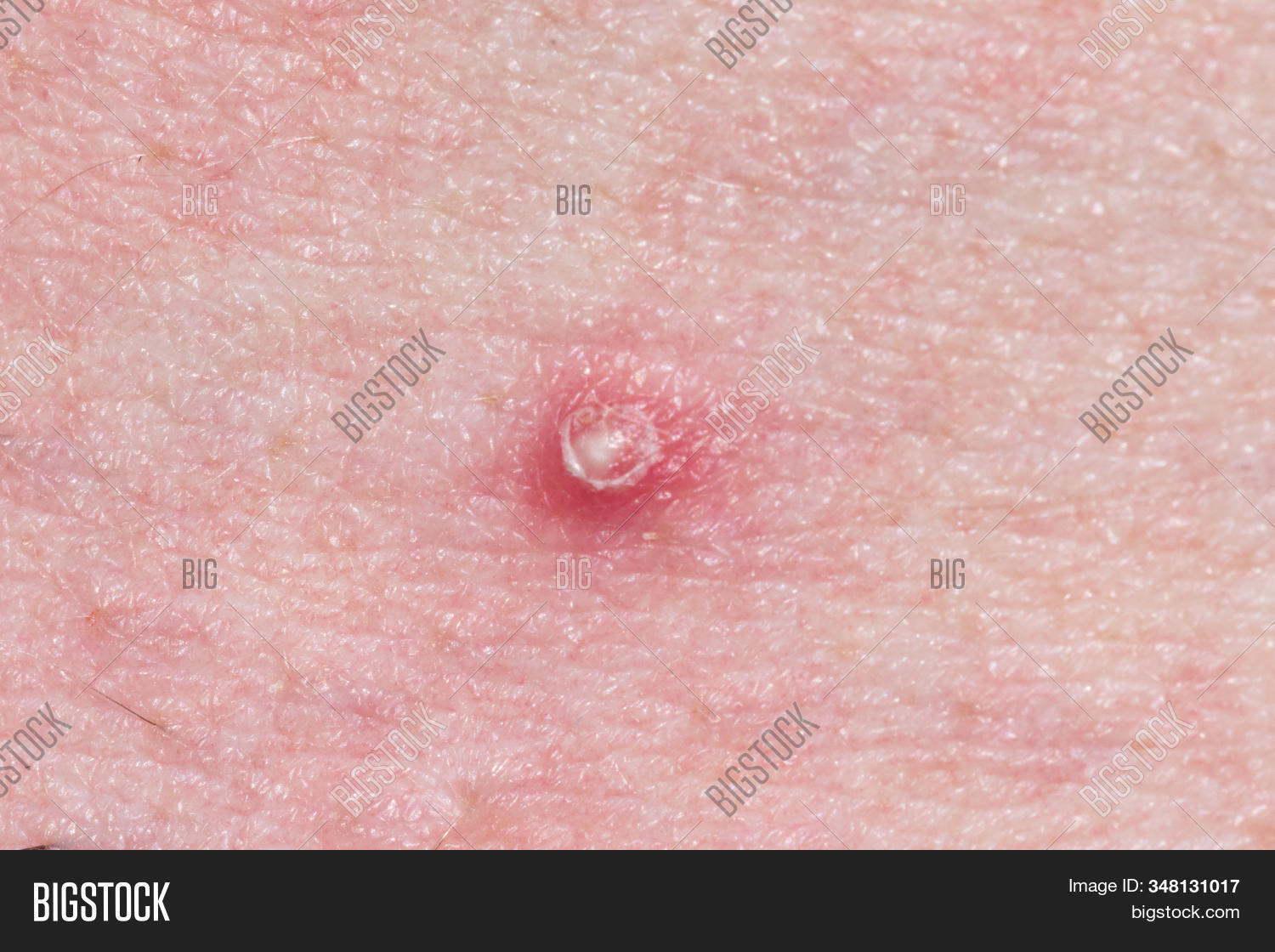 Close- Whitehead Image & Photo (Free Trial) | Bigstock