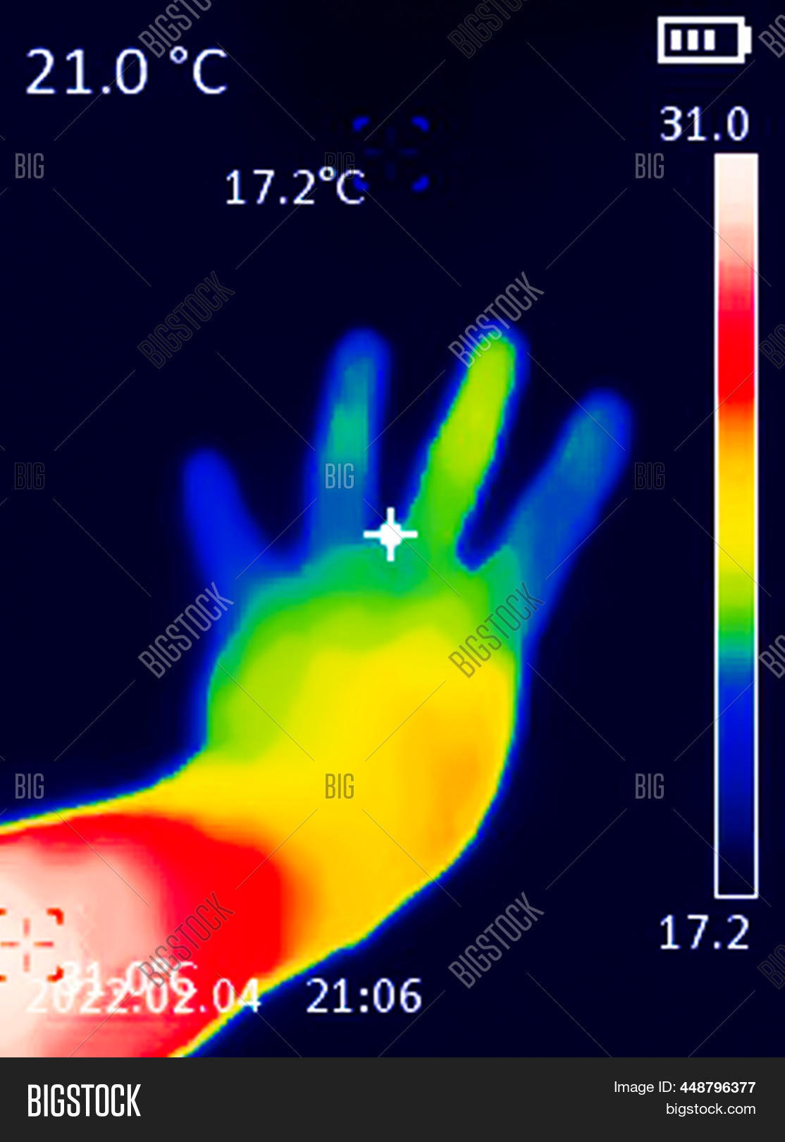 Thermographic Image Image & Photo (Free Trial) | Bigstock