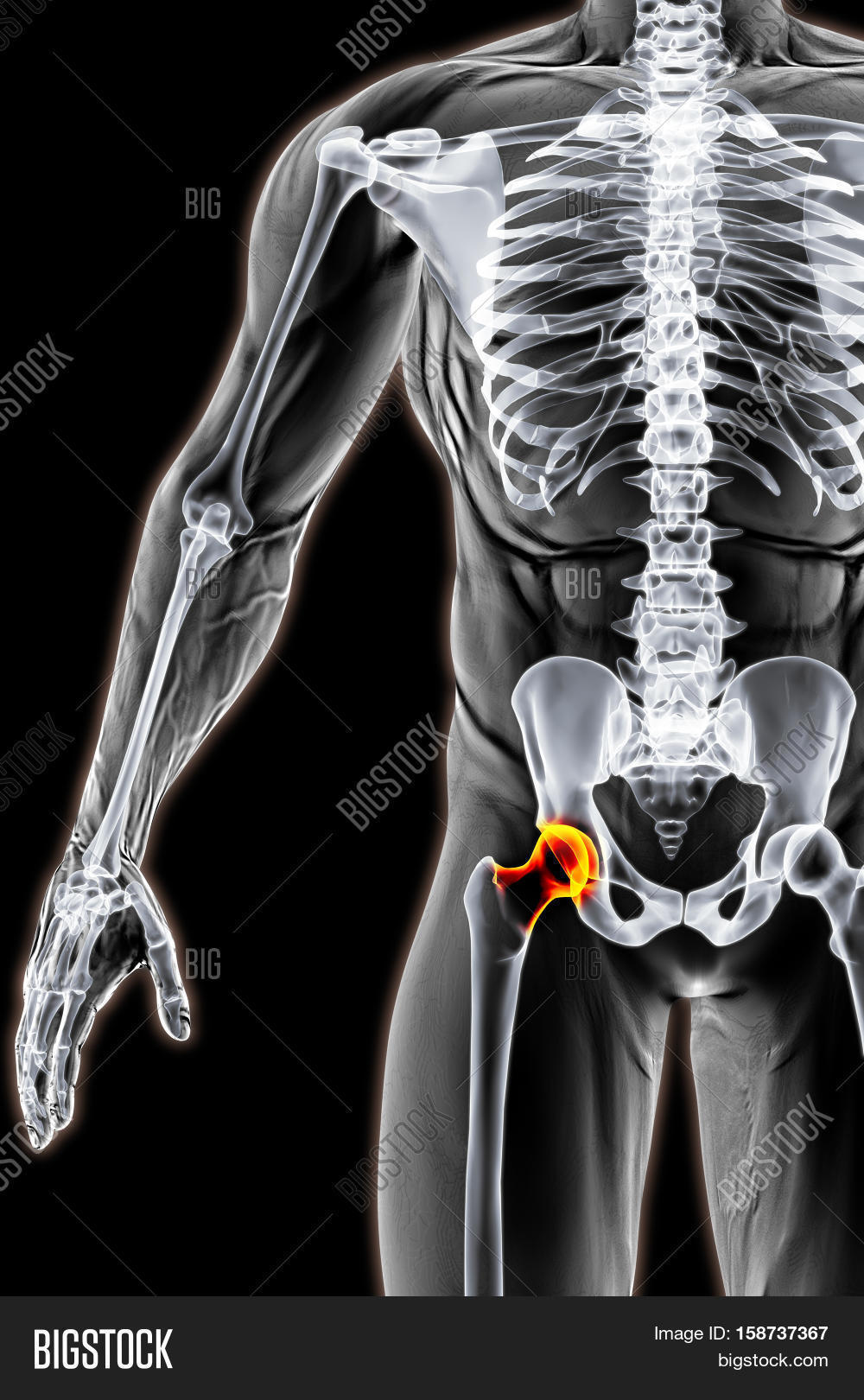 Male Pelvis Under X- Image & Photo (Free Trial) | Bigstock