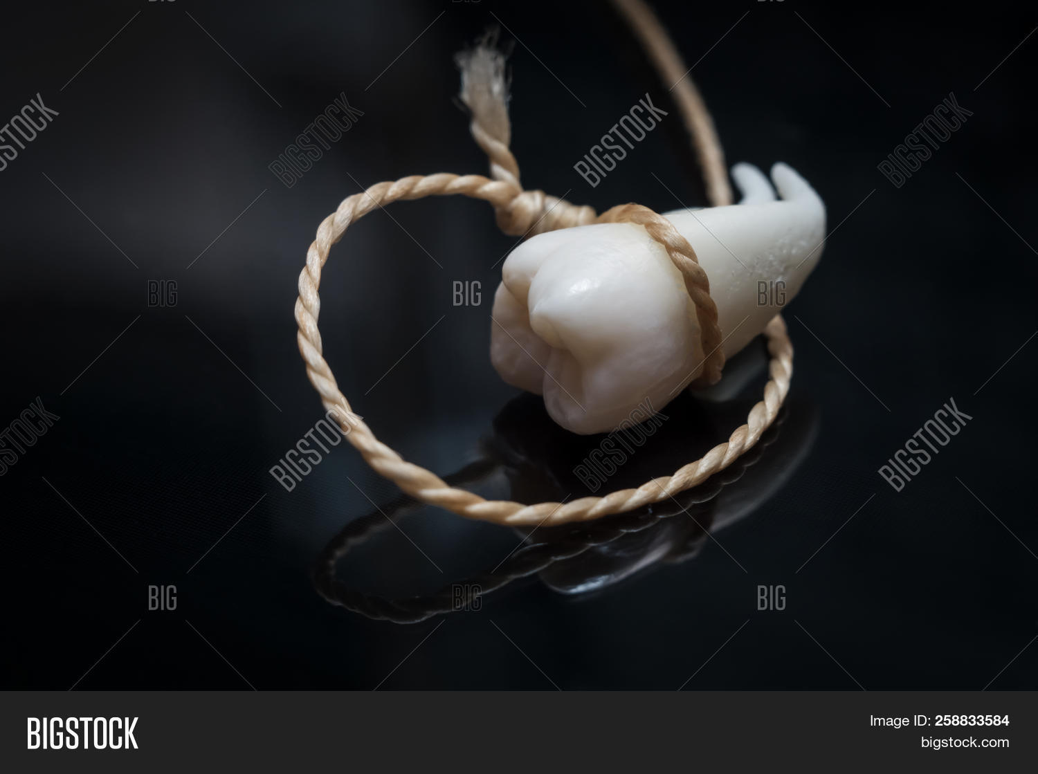 Wisdom Tooth Roots Image & Photo (Free Trial) | Bigstock