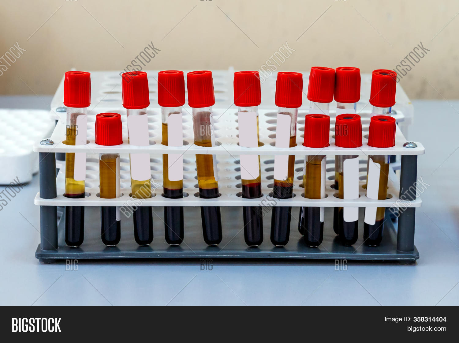 Blood Tubes Tray Image & Photo (Free Trial) | Bigstock