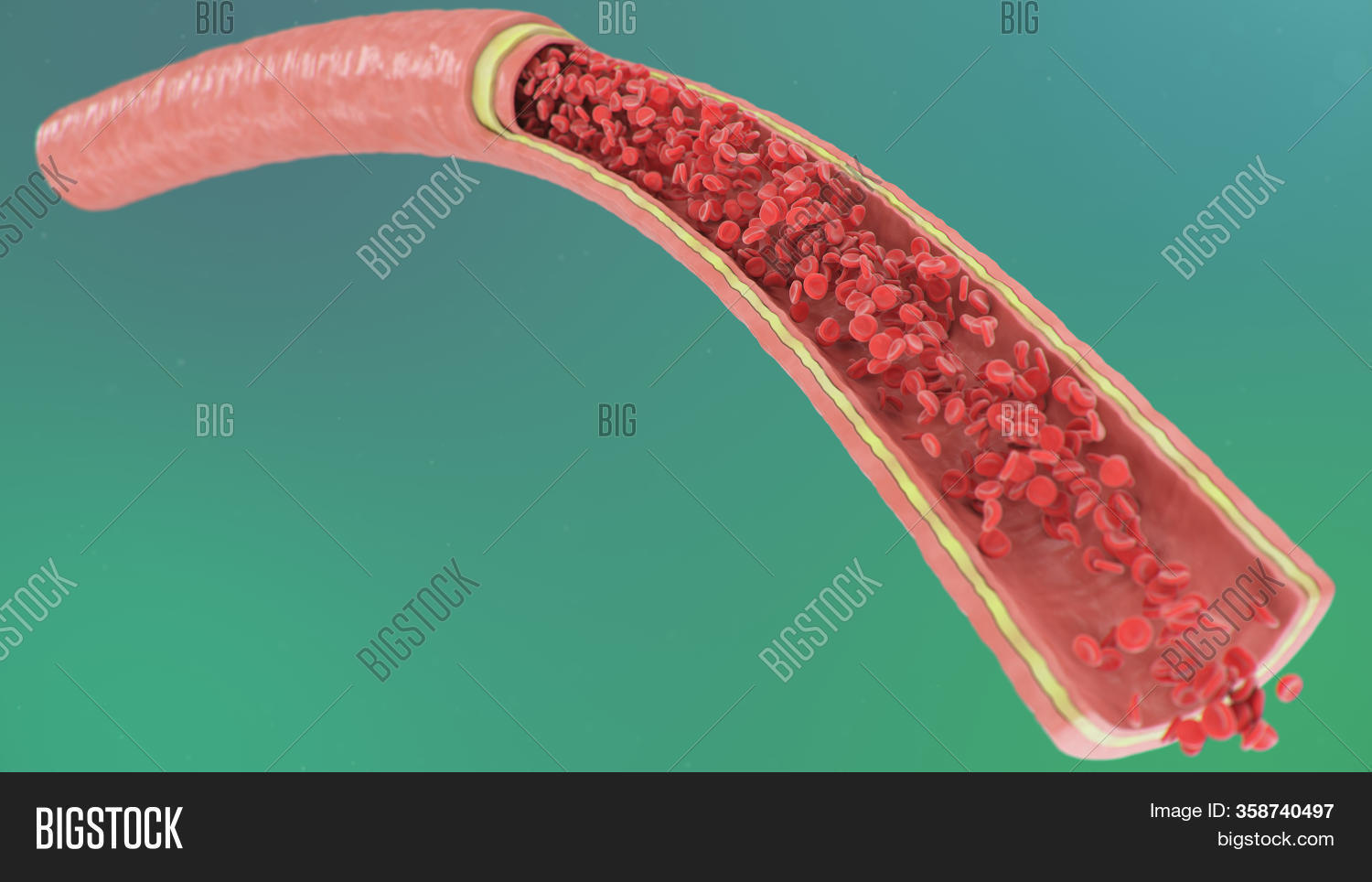 Cross Section Artery Image & Photo (Free Trial) | Bigstock
