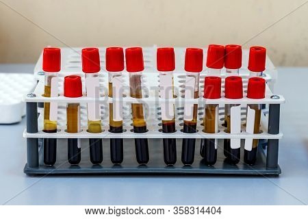 Blood Tubes Tray Image & Photo (Free Trial) | Bigstock