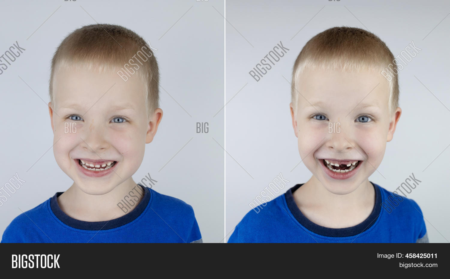 Before billede og foto (gratis prøveperiode) | Bigstock